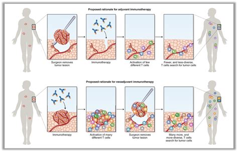 Neoadjuvant Adjuvant Behandling Msd Innsikt