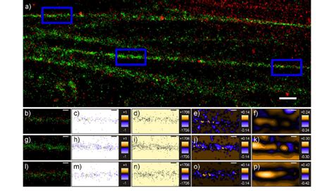 Coordinate Based Colocalization Cbc Of A Dual Stained Actin Structure