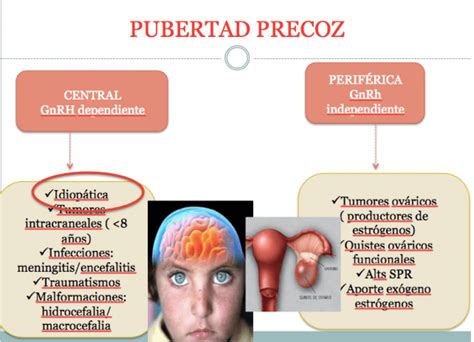 Pubertad Precoz Manejo Multidisciplinar Dra De La Calle María De