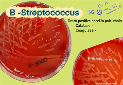 Beta Streptococcus Micro Twenty Four Hours