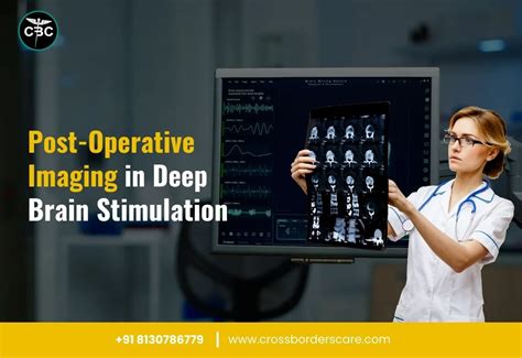 Deep Brain Stimulation Surgery