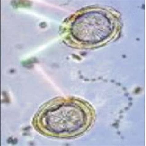 Dental Nanorobot Fig 2 Components Of A Nanorobot Download Scientific Diagram