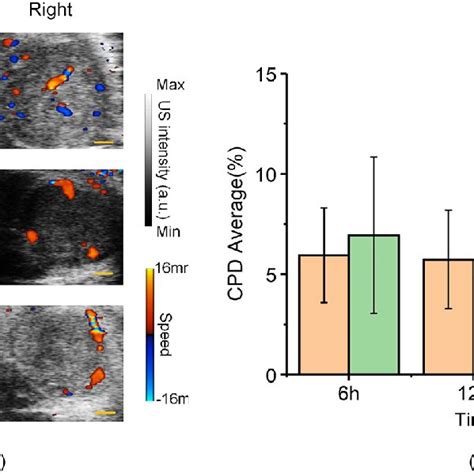Spectral Doppler Usi Evaluation Of Incomplete Tt Models At 6 H 12 H Download Scientific