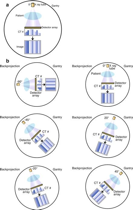 Basic Principles In Computed Tomography Ct Thoracic Key