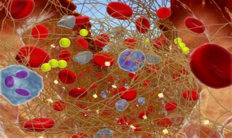 Video Randomized Trial Of Prophylactic Platelet Transfusions