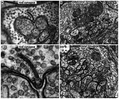 Photoreceptor Ribbon Synapses In Ac Rod Photoreceptor Ribbon