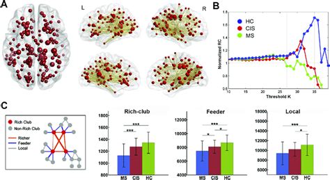 Rich Club Organization Of High Resolution Brain Structural Connectome Download Scientific