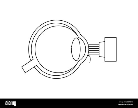 Illustration Of Lasik Laser Assisted In Situ Keratomileusis Also