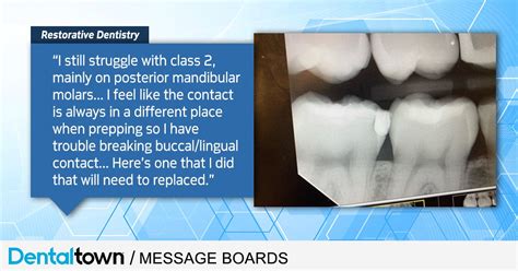 Dentaltown On Linkedin Do You Have Any Advice On How To Improve Class 2…