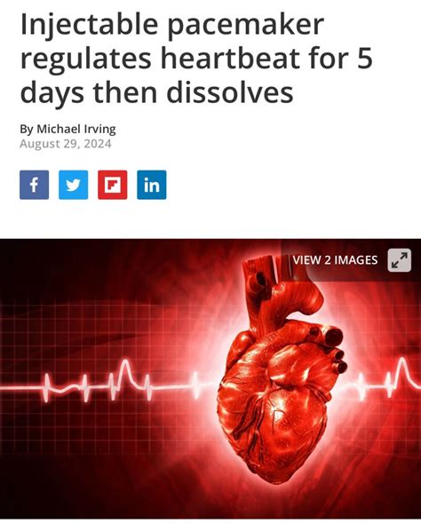 Pacemaker Arrhythmia Nanoparticle Nature Professor Erwin Loh