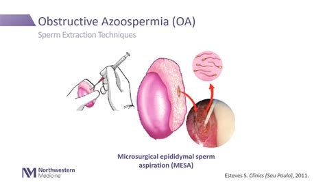 Male Infertility Guidelines Diagnosis Treatment Options And Male Infertility Guidelines Diagnosis Treatment Options And