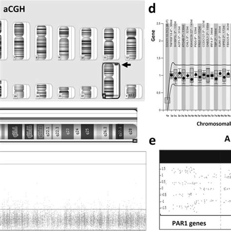 Snp Microarray Results Of The Index Case Identify Duplication Of Xp As Download Scientific