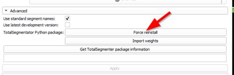 Totalsegmentator Error In First Use Tried Multiple Times Of Uninstall And Reinstall Support