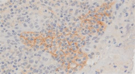 Human Tonsil Tissue Normal Ffpe Sections