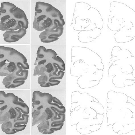 Comparison Of Correspondence Structure Between Deterministic Annealing Download Scientific