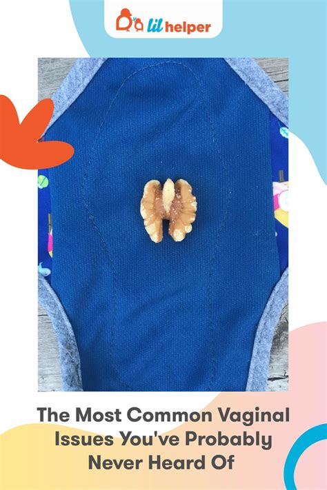 The Most Common Vaginal Issues Youve Probably Never Heard Of