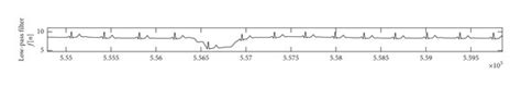 The Phases Of Qrs Complex Detection In F1o09 Case A Low Pass Filter