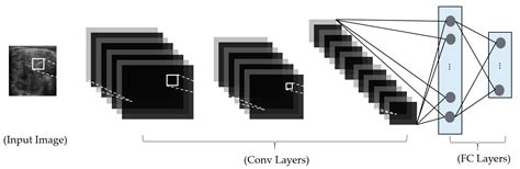 Artificial Intelligence Based Thyroid Nodule Classification Using Information From Spatial And