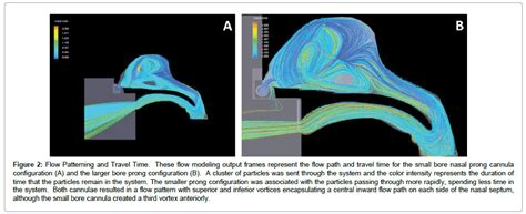 computational fluid dynamics modeling of extrathoracic airway flush