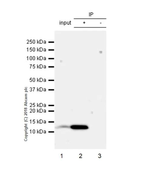 Anti Beta 2 Microglobulin Antibody Epr21752 214 Ab218230 Abcam