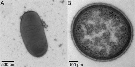 Fossilized Bacteria Examples At Peggy Bergmann Blog