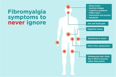 Trigger Points In Fibromyalgia