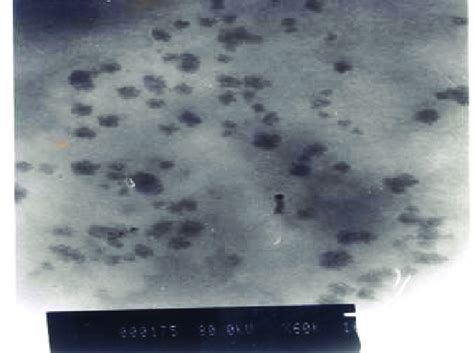 tem picture of pei activated peg 8332 10 size 40 60nm morphology