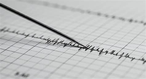 Electrocardiogram Analysis Probe Examining Abnormal Heart Rhythm On Grid Paper Stock