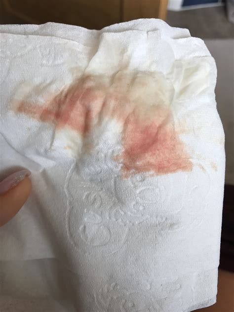 What Causes Light Pink Spotting At 7 Weeks Pregnant At Amanda Gregory Blog