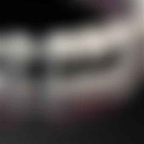 Understanding Braces Components Braces Pros