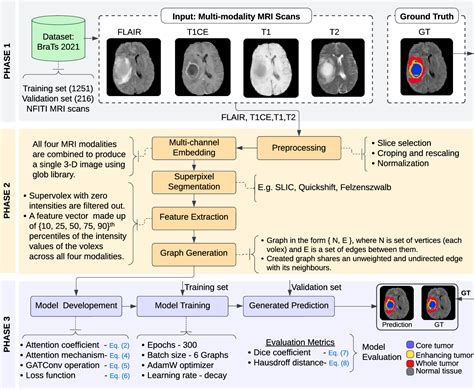 Multi Class Brain Tumor Segmentation Using Graph Attention Network