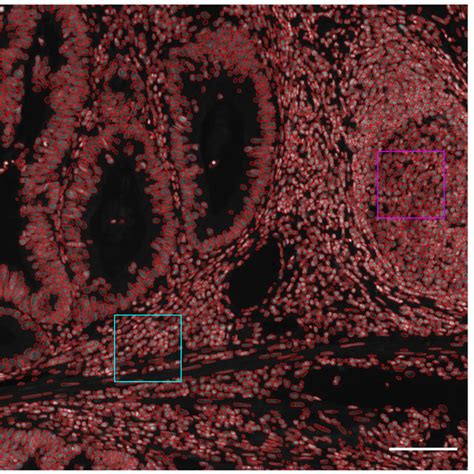 nuclear segmentation example when combining u net and mask r cnn