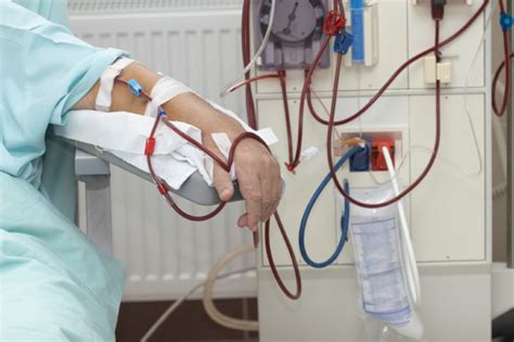 Urgent Hemodialysis Feasible For Perioperative Hyperkalemia In Ptx