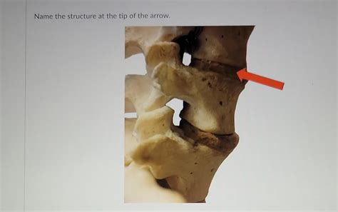 Solved Name The Bone Marker At The Tip Of The Arrow Name