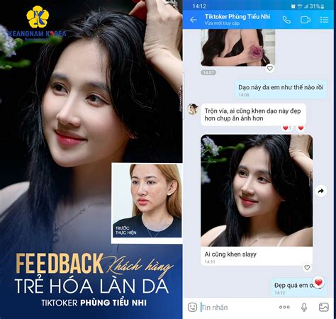 Feedback Beauty With Smooth White Skin Beautiful Photos From Every Angle 💖 Tiktoker Phung Tieu