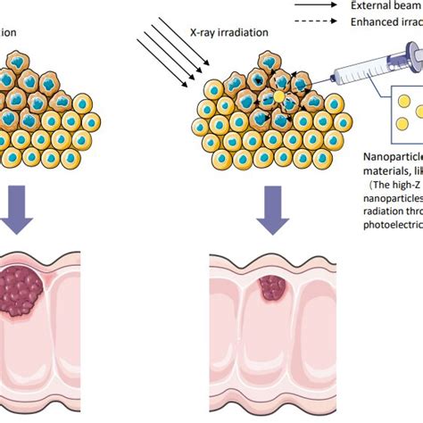 The Implications Of Nanoparticles Containing Radiosensitizing Drug Download Scientific Diagram