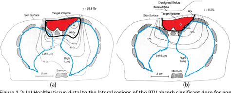 Evaluation Of The Pencil Beam Algorithm And Pencil Beam Redefinition