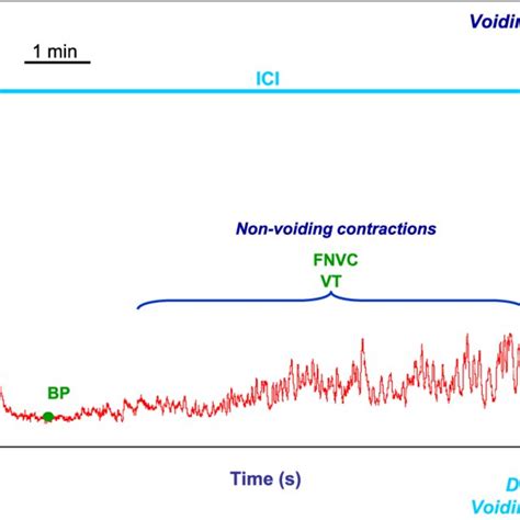 Illustration Of The Parameters Computed For Bladder Voiding And Download Scientific Diagram