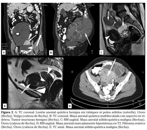 Radiologia Resonancia Magnética Pélvica