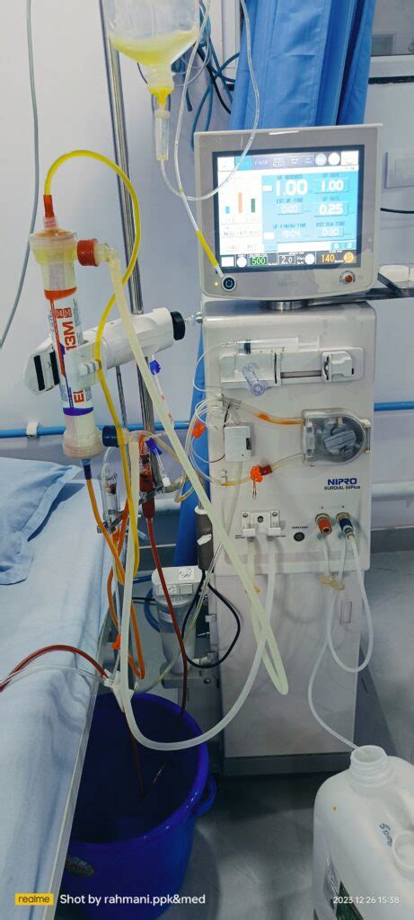 Whats Is Dialysis Principal Of Dialysis Dialysis Definition