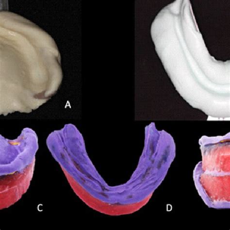 A Scanning Of Maxillary Impression B Scanning Of Mandibular