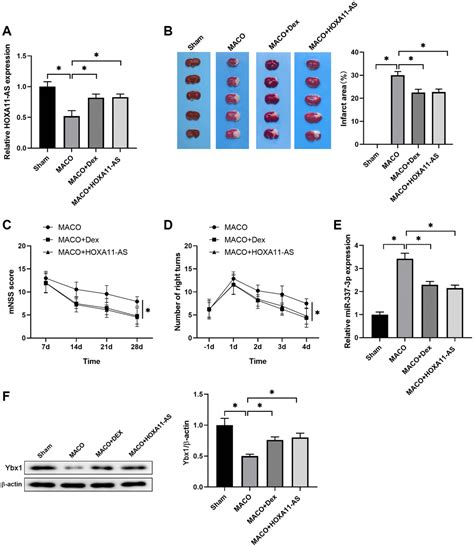 long non coding rna hoxa11 as regulates ischemic neuronal death by