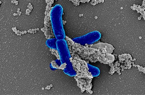 Fcmbl Broad Spectrum Pathogen Capture For Infectious Disease Diagnosis And Therapy