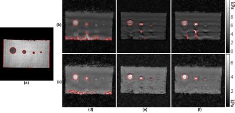 The Unified Level Set Model With Balanced Controlling Parameters Download Scientific Diagram
