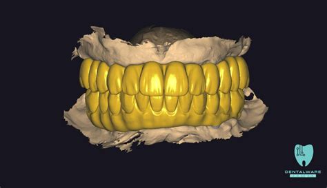 Exocad Advanced CAD CAM Software For Digital Dentistry Exocad Advanced CAD CAM Software For Digital Dentistry