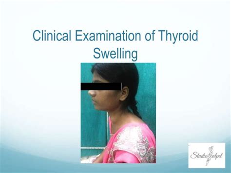 Thyroid Swelling A Practical Guide On Writing And Presenting A Clinical Case Pptx Thyroid