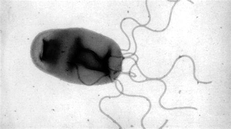 Pin On Health And Wellbeing