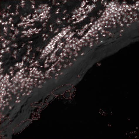 Filtering The Cells Detected After Running Qupath Stardist Cell