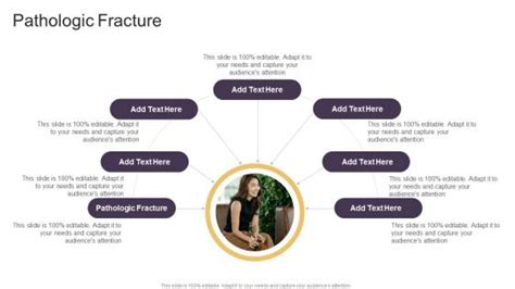 Pathologic Fracture Powerpoint Templates Slides And Graphics
