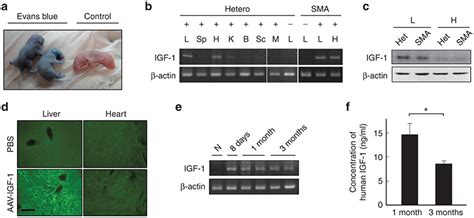 Expression Of Human Igf 1 Following Intravenous Administration Of